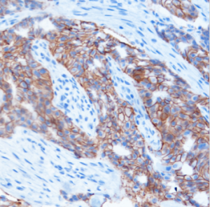 REAL EnVision Detection System