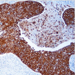 MicroStacker TM Polymer Detection, Universal