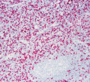 Immune Chromogenic Reagent (Fast Red)