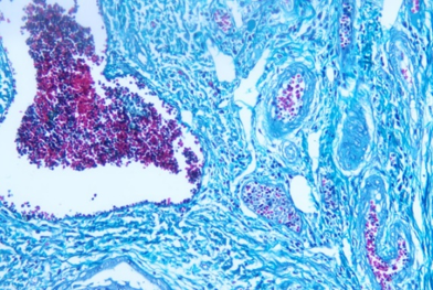 Masson Trichrome Staining Kit