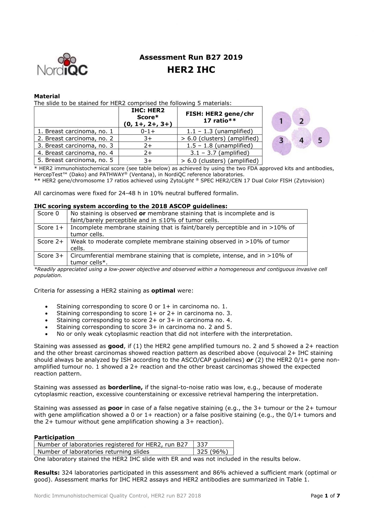 NordiQC Assessment-HER2 IHC mAb clone C1F7