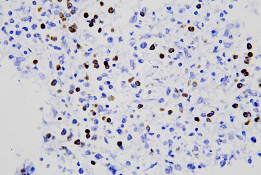 Kappa/Lambda Probe Kit (ISH)