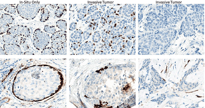 The Meaning of the IHC Markers