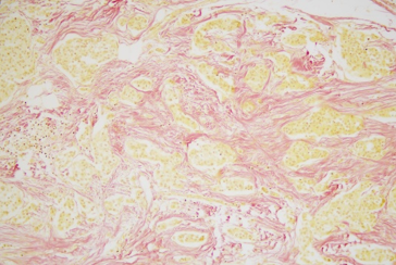 Van Gieson Staining Kit