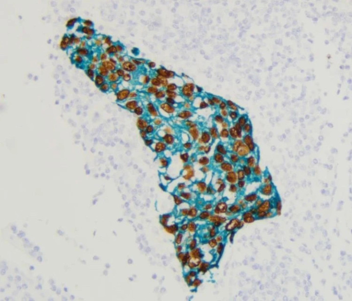 Albumin CISH probe, Super-ISH™