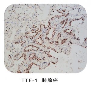 Fast Frozen IHC solution introduction