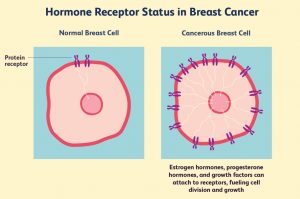 A Guide to Hormone Receptor Status What Happens If ER Is Positive